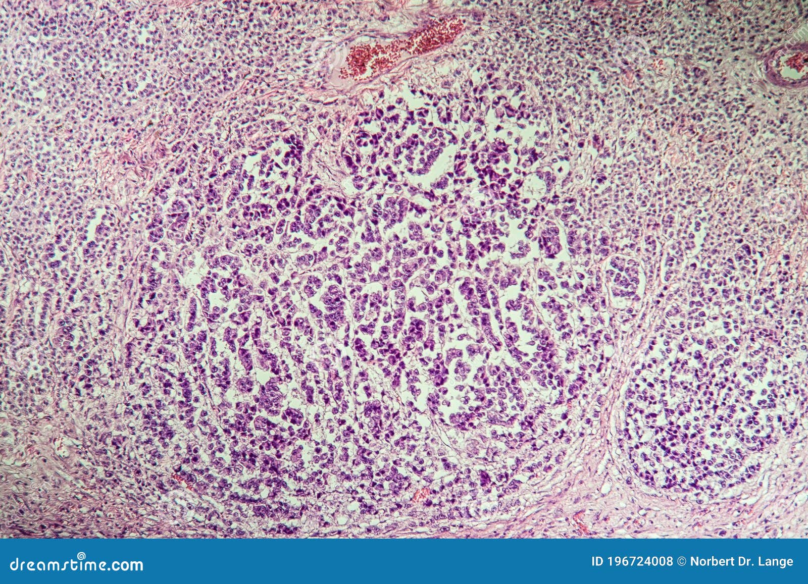 Spinal cord tissue section stock photo. Image of medicine - 196724008