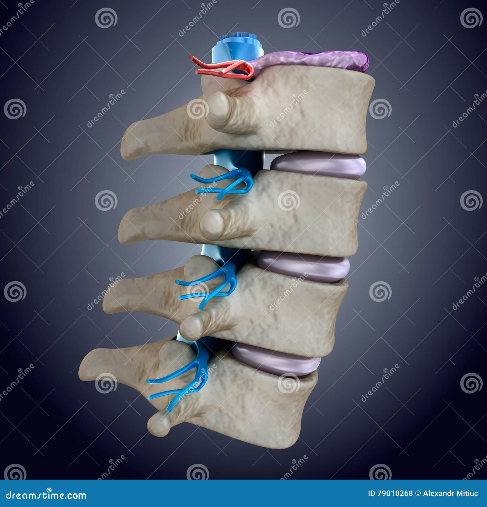 Spinal Cord Under Pressure of Bulging Disc Stock Illustration ...