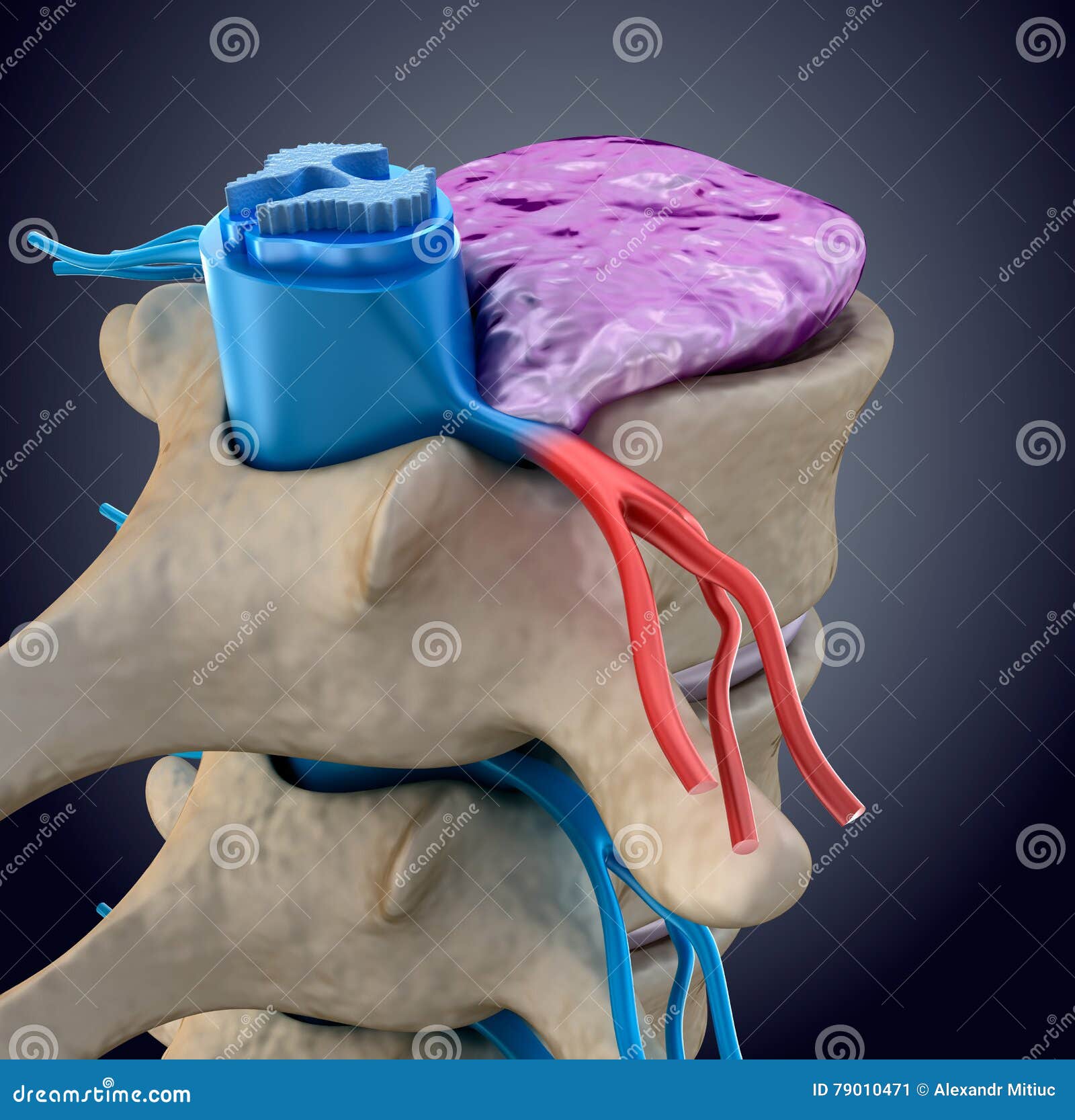 Spinal Cord Under Pressure Of Bulging Disc Royalty-Free Stock ...