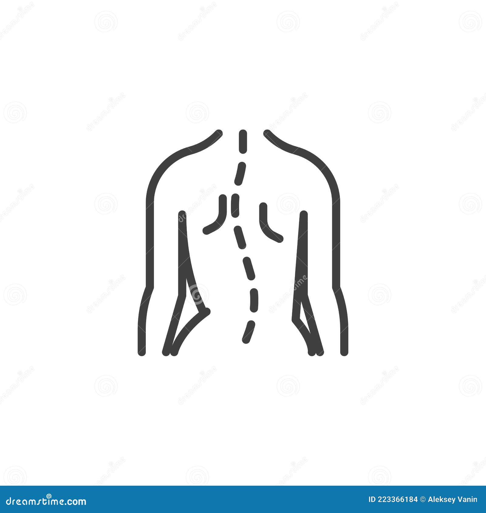 Spinal Deformity, Scoliosis And Spine Backbone Curvature Concept ...