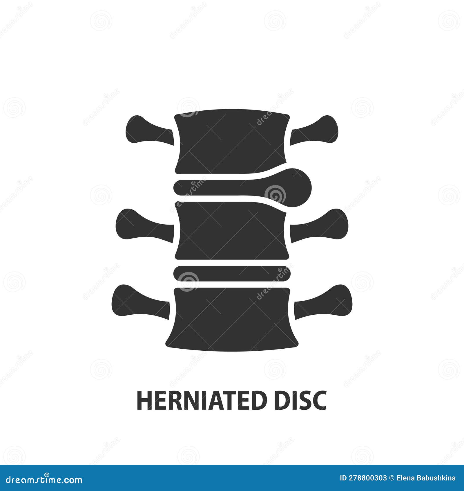 Spinal Disc Herniation Glyph Icon. Herniated Disc Vector Sign Stock ...