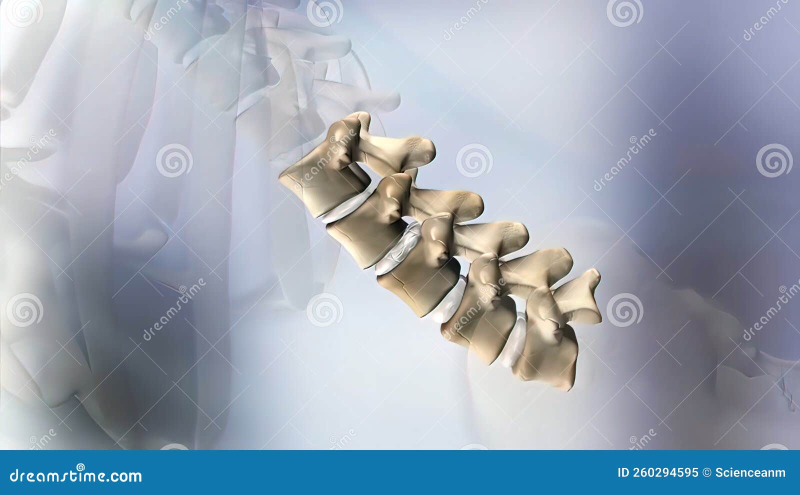 Spinal Disc Irritation and Its Effect on the Body Stock Illustration ...