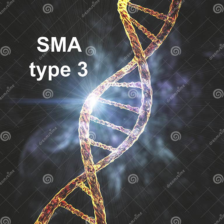 Spinal Muscular Atrophy Sma A Genetic Neuromuscular Disorder Stock