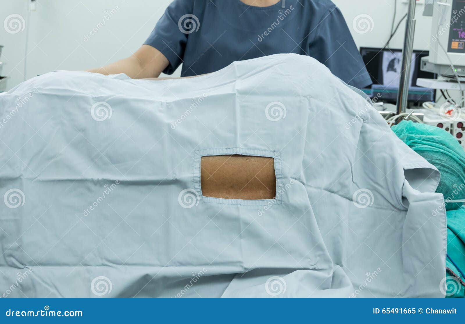 Spinal nerve block stock image. Image of glove, human - 65491665