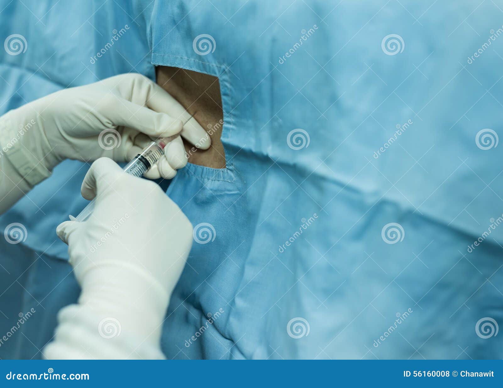 Spinal nerve block stock photo. Image of hand, paraplegia - 56160008