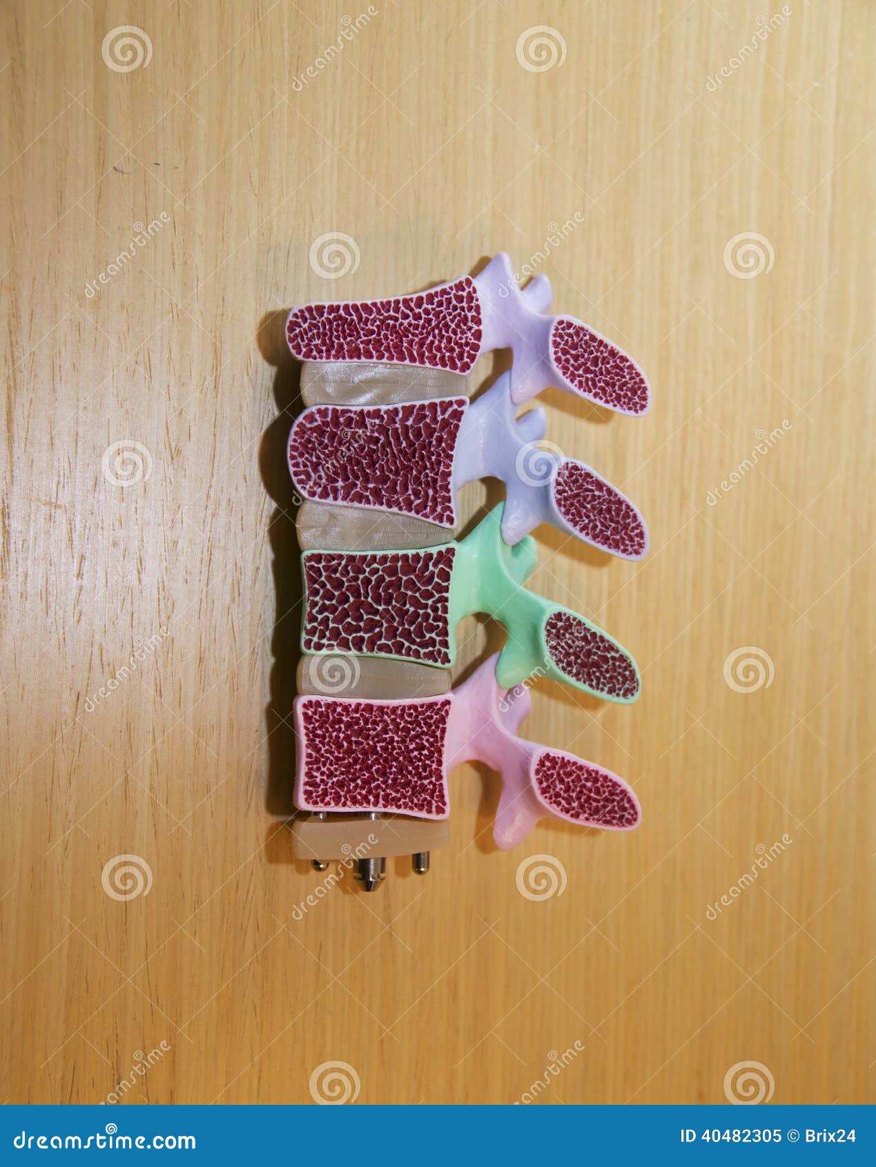 Spinal Vertebrae Pathology Colorful Collage Stock Photo | CartoonDealer ...