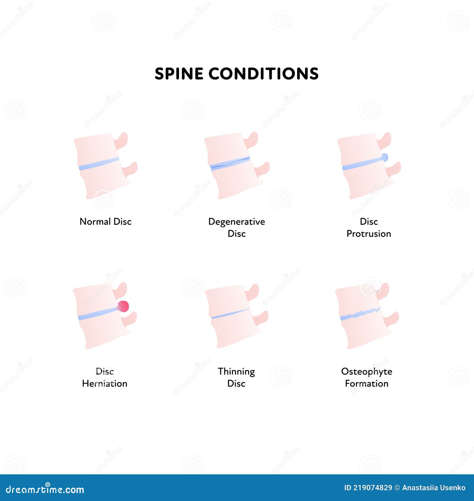 Leg Protrusion Icon. Simple Line Element Leg Protrusion Symbol For ...