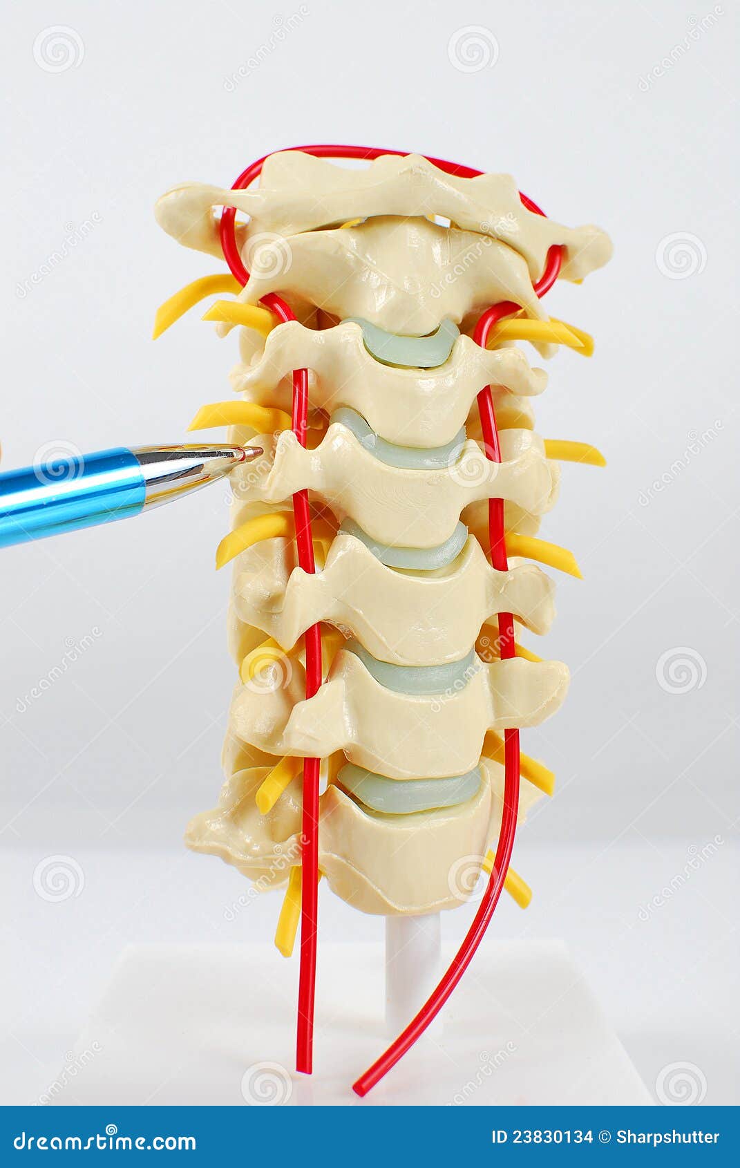 Model Of Spine Showing Porous Bone Marrow In Case Of Osteoporosis Stock ...