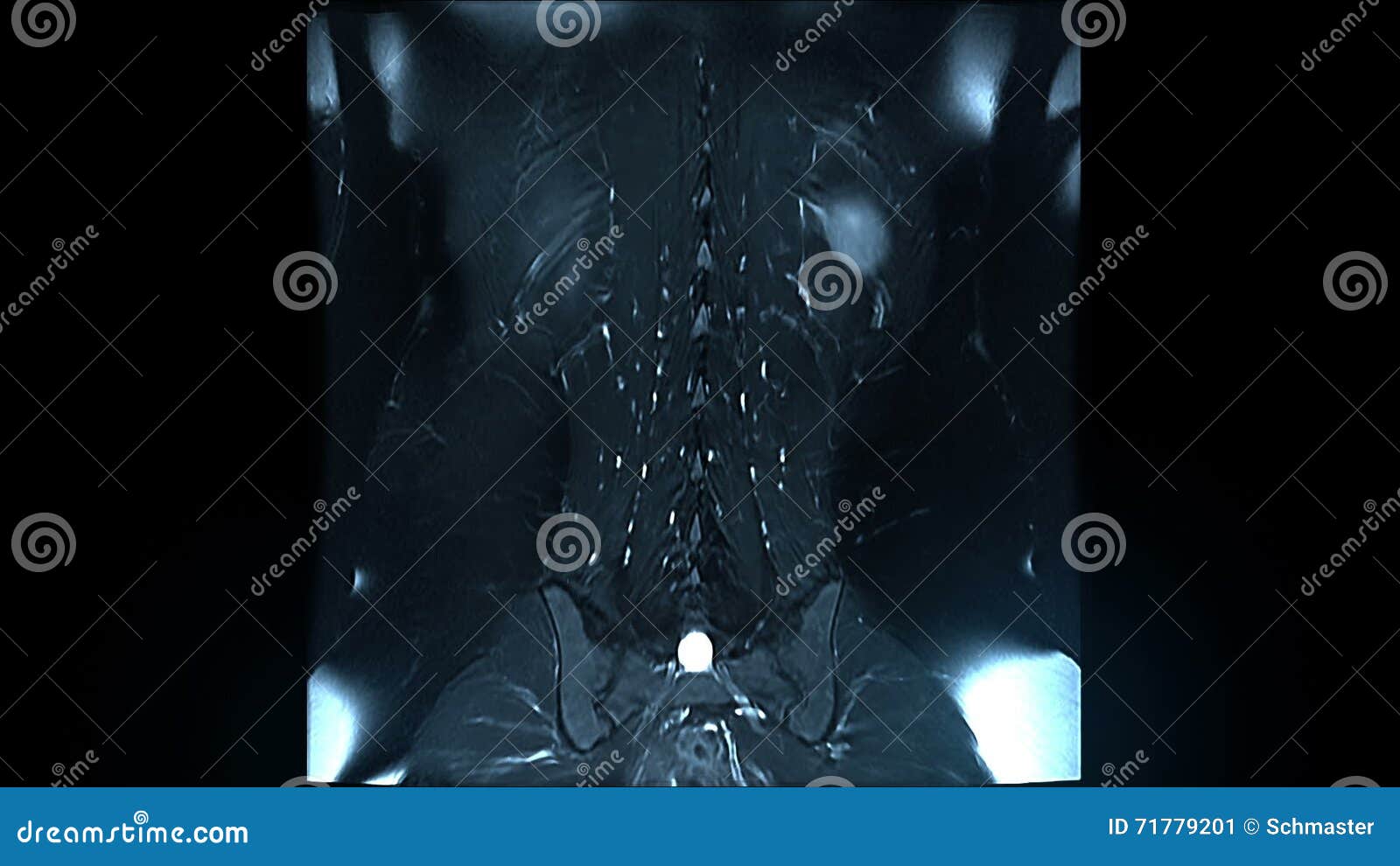 Spine MRI Scan stock video. Video of anatomy, radiology - 71779201