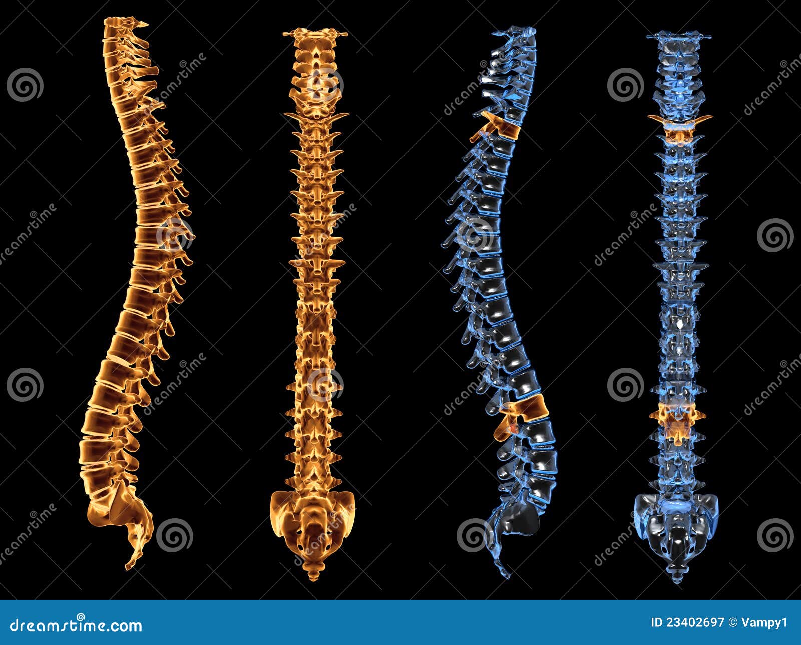 Spine and spinal x-ray stock illustration. Illustration of posture ...