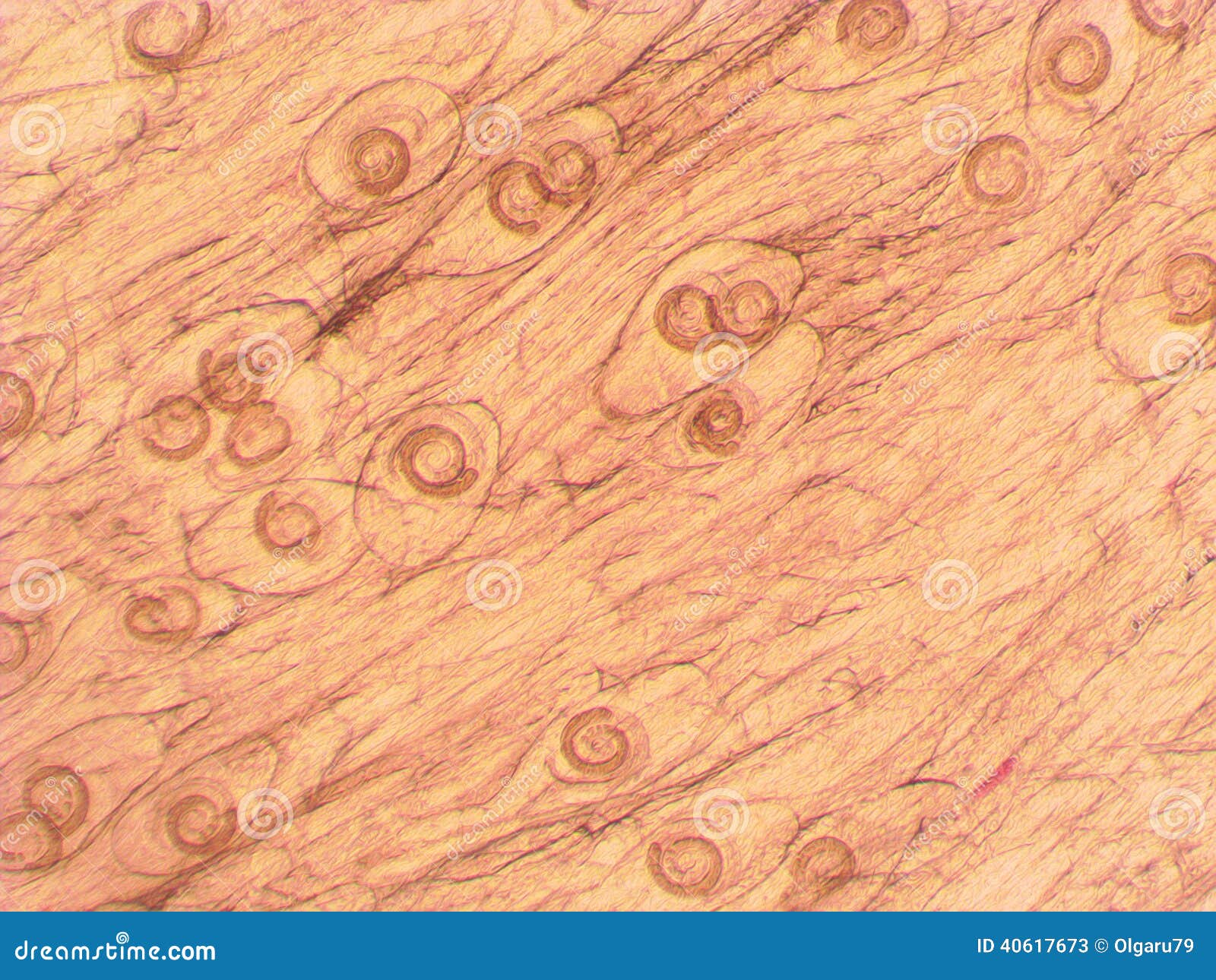 Spiralis De Trichine - Microscope De Ver Parasite Image stock - Image ...