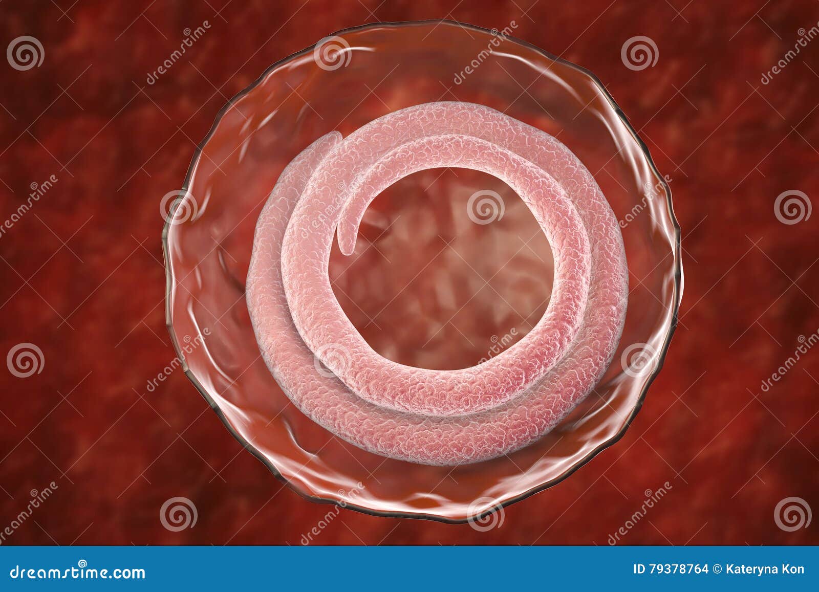 Spiralis Della Trichina Degli Ascaridi Illustrazione di Stock ...