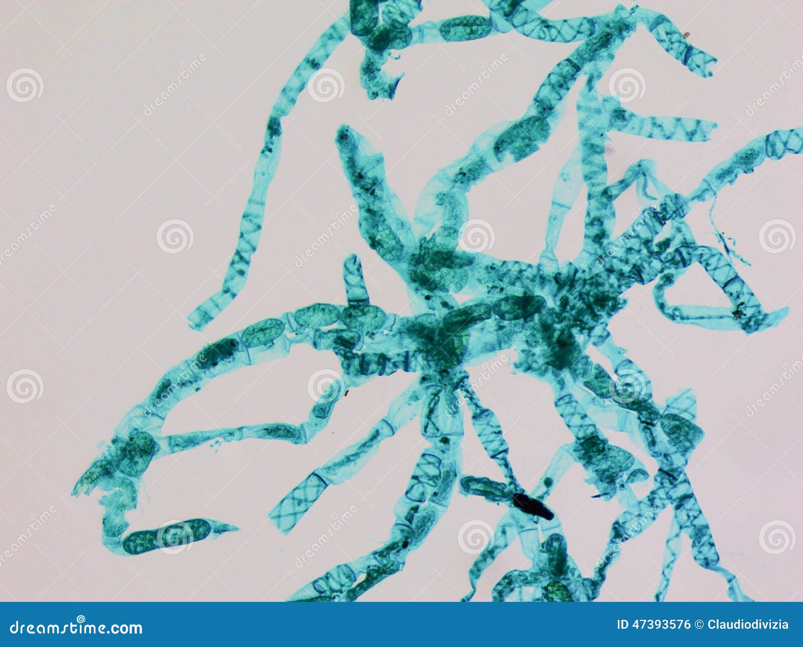 Spirogyra Microscope Slide