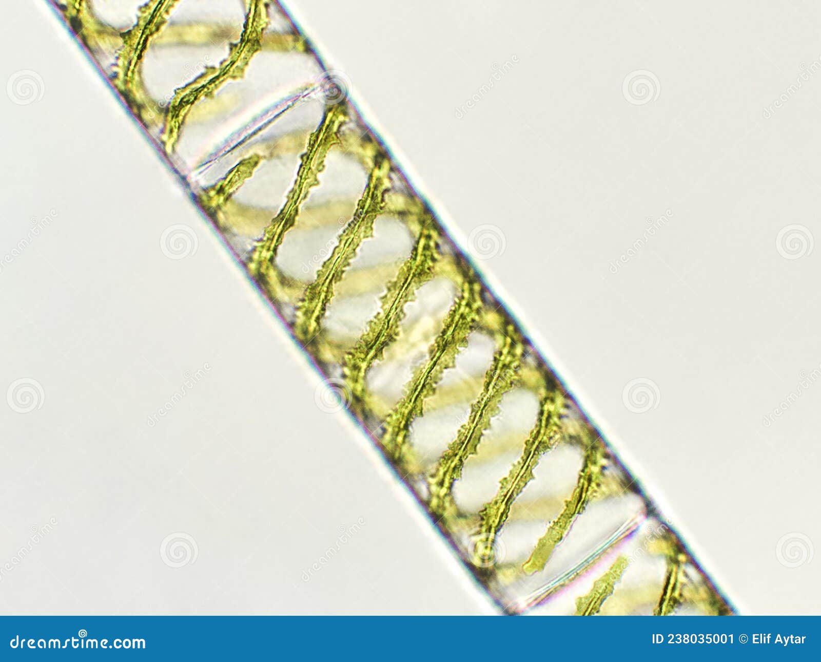Spirogyra Under Microscope 400x
