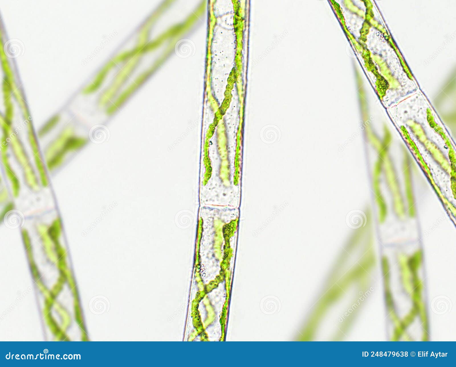 Spirogyra Sp. Green Algae Under Microscopic View X40 - Chlorophyta ...