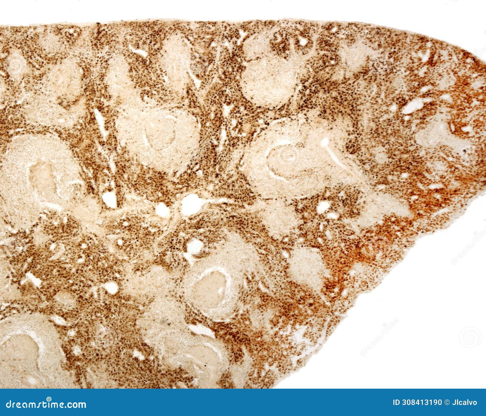 Small Intestine. Paneth Cells Stock Photo - Image of light, paneth ...