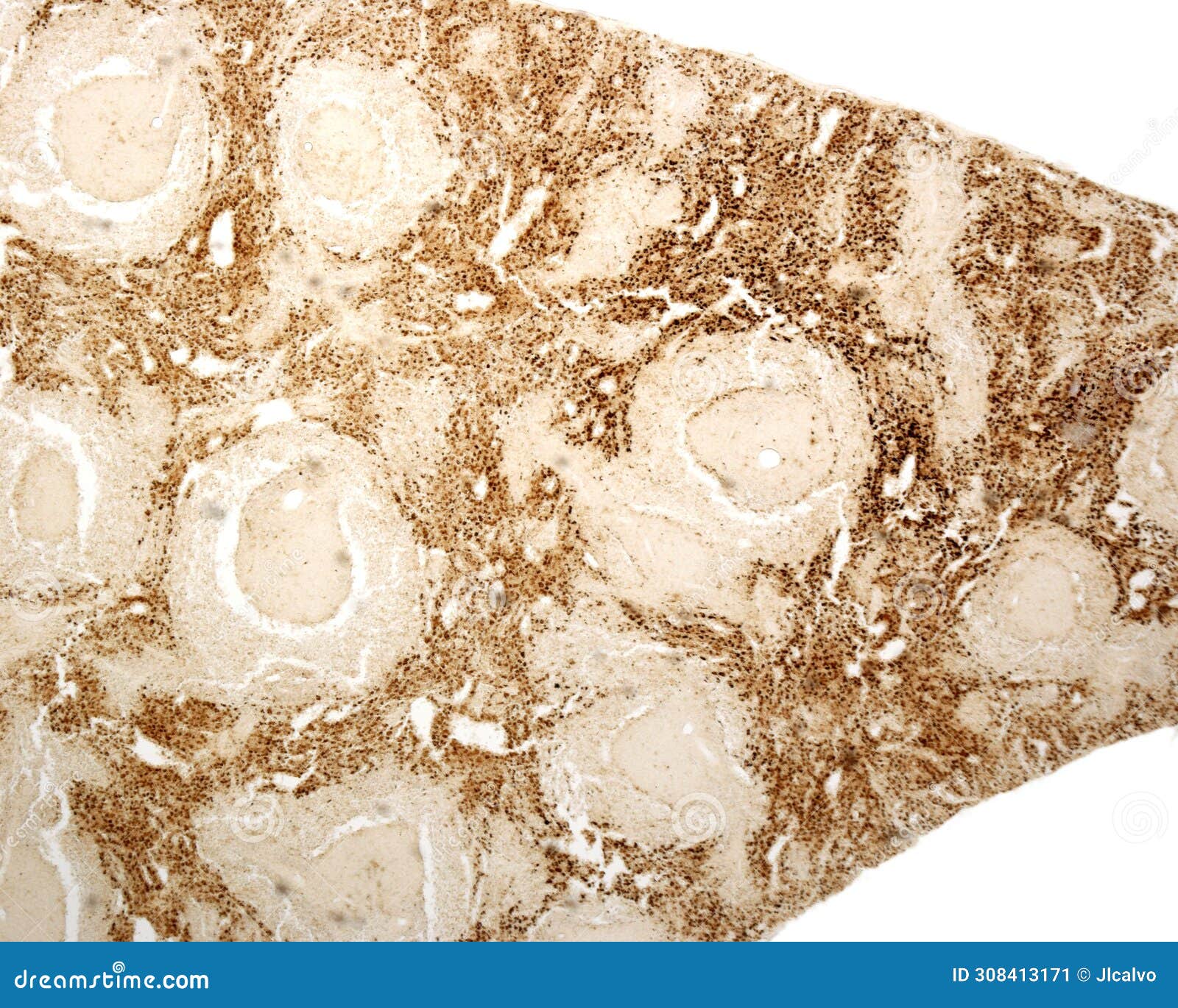 Small Intestine. Paneth Cells Stock Image - Image of defensin ...