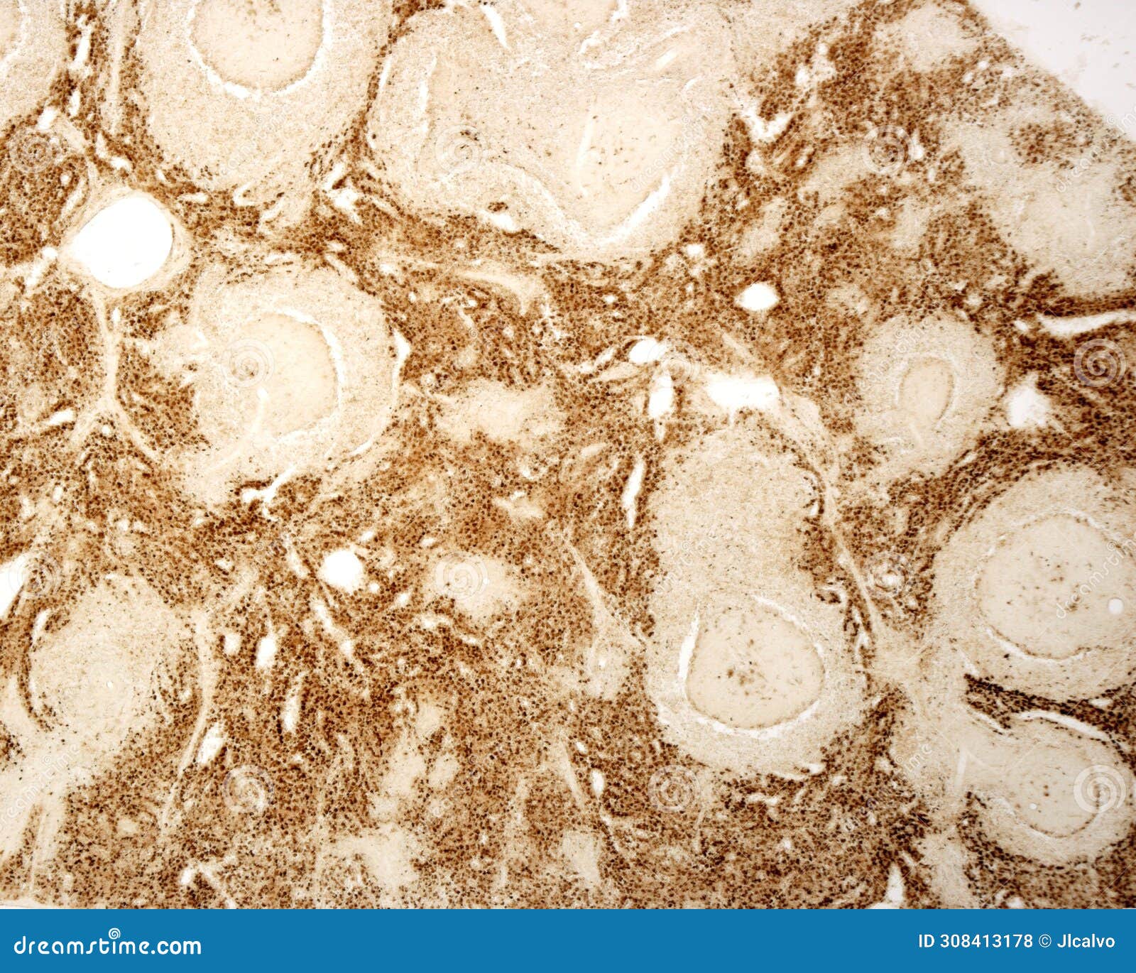 Small Intestine. Paneth Cells Stock Photo - Image of lieberkafrac14 ...