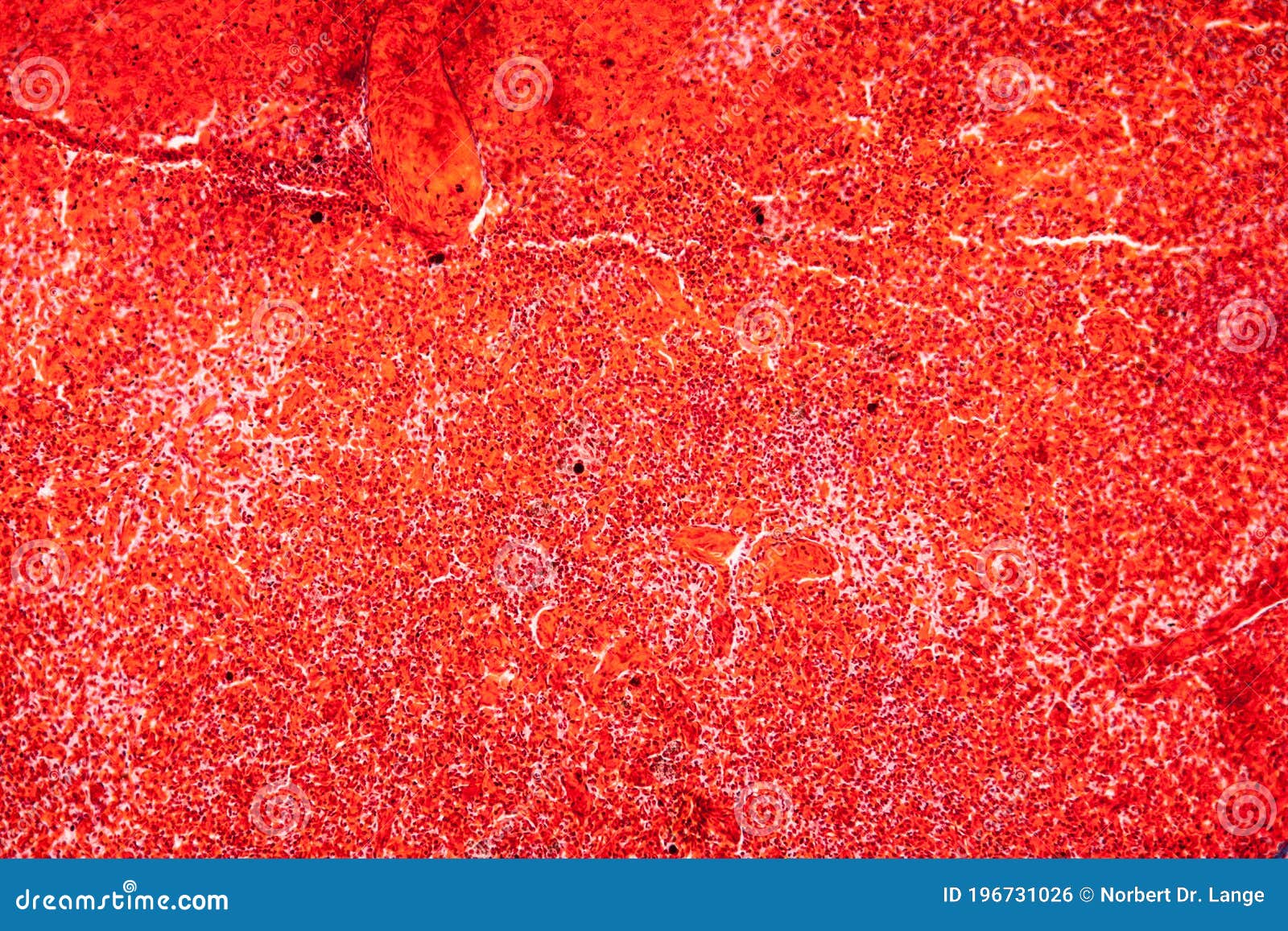 Spleen tissue stock photo. Image of research, magnification - 196731026