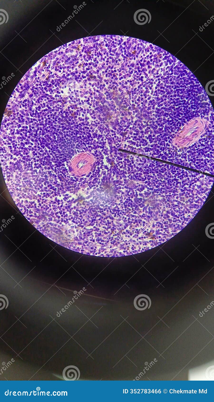 Spleen Under the Microscope Stock Photo - Image of microscope ...