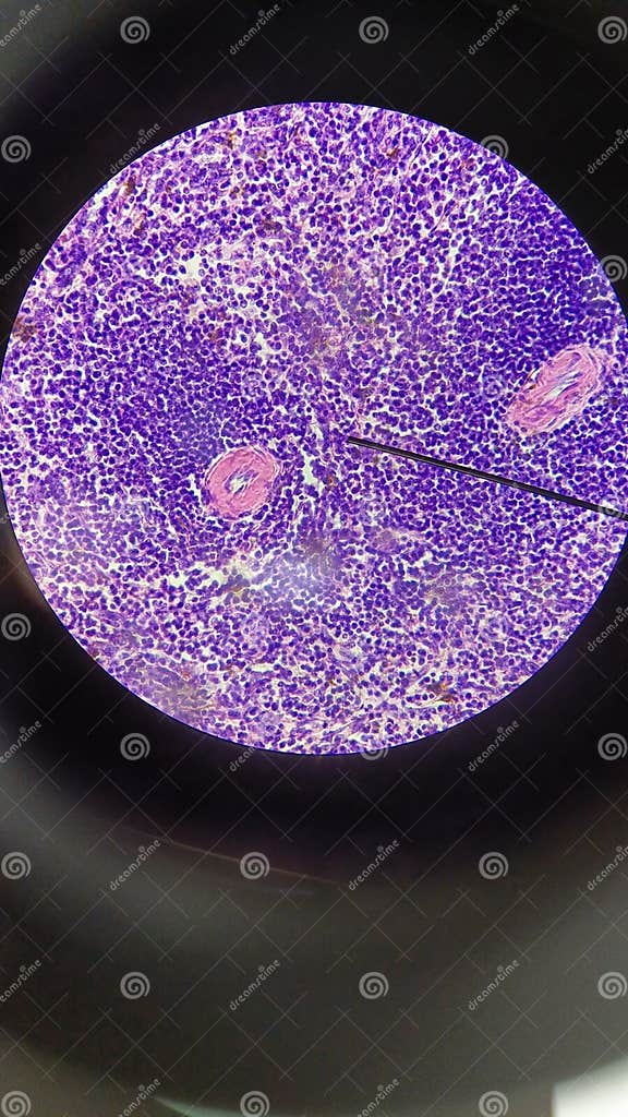 Spleen Under the Microscope Stock Photo - Image of microscope ...