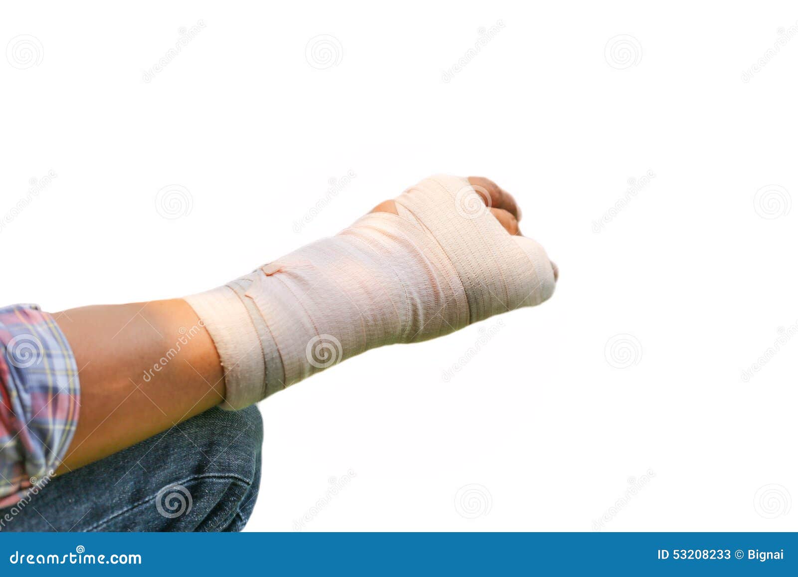Splint,broken Bone,broken Hand Isolate On White Background Royalty-Free ...