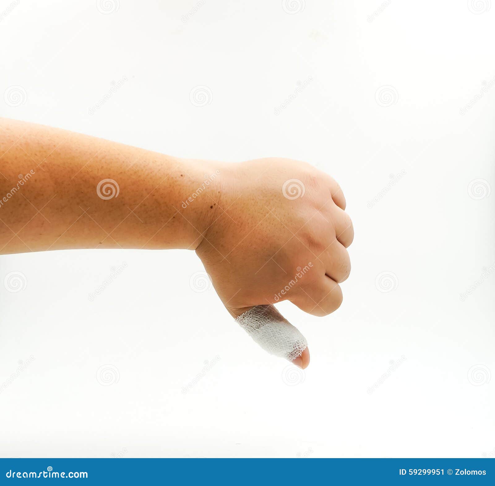 Splint Finger A Broken Bone Royalty-Free Stock Photo | CartoonDealer ...