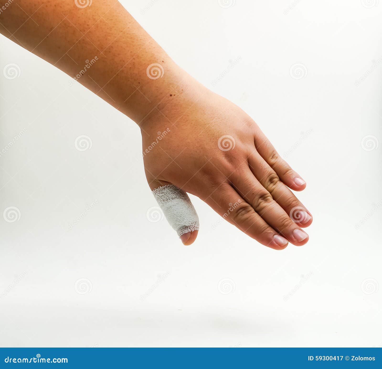 Splint Finger A Broken Bone Royalty-Free Stock Photo | CartoonDealer ...