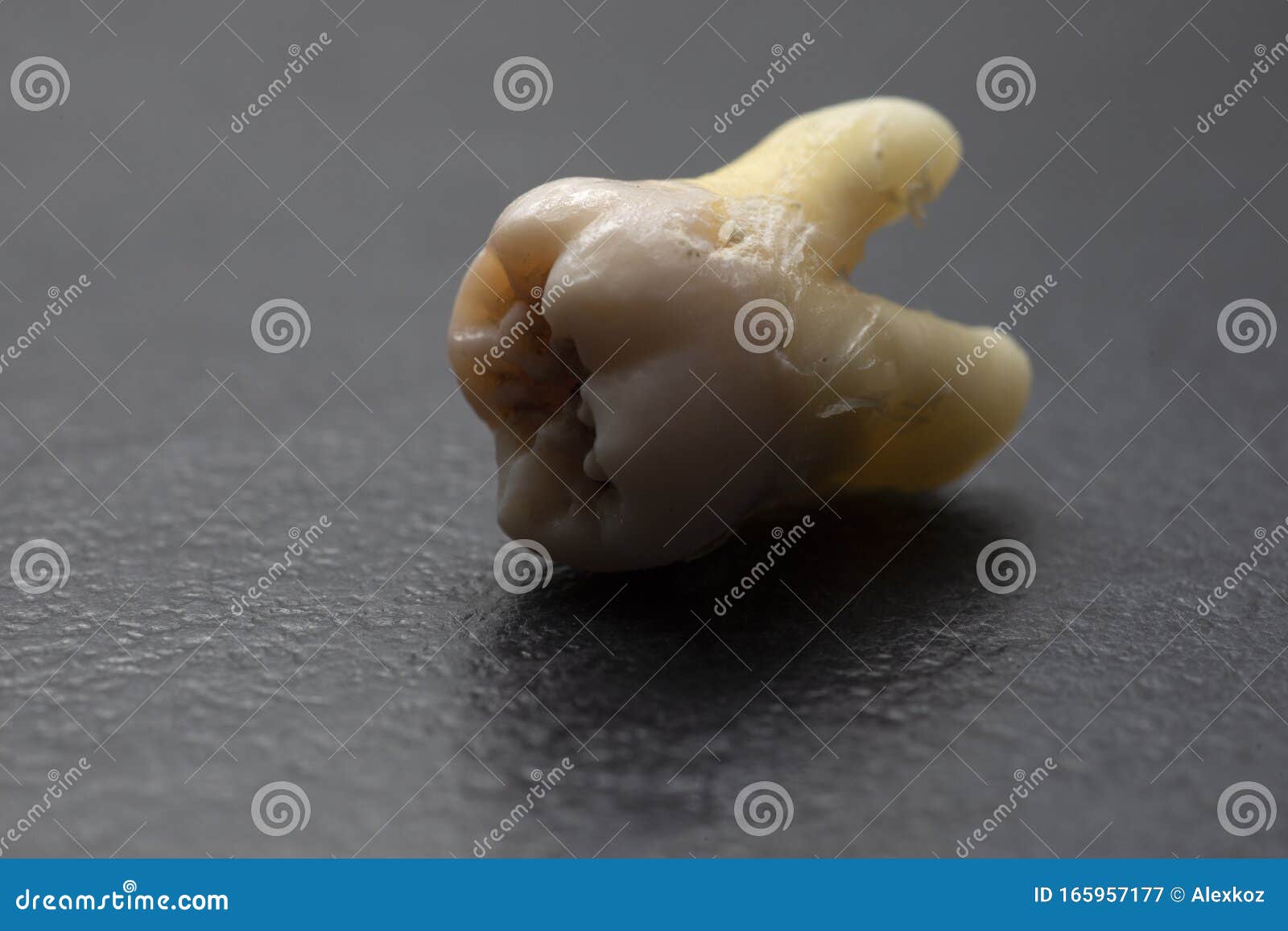 Spoiled Human Tooth on Black Background Stock Image - Image of dental ...