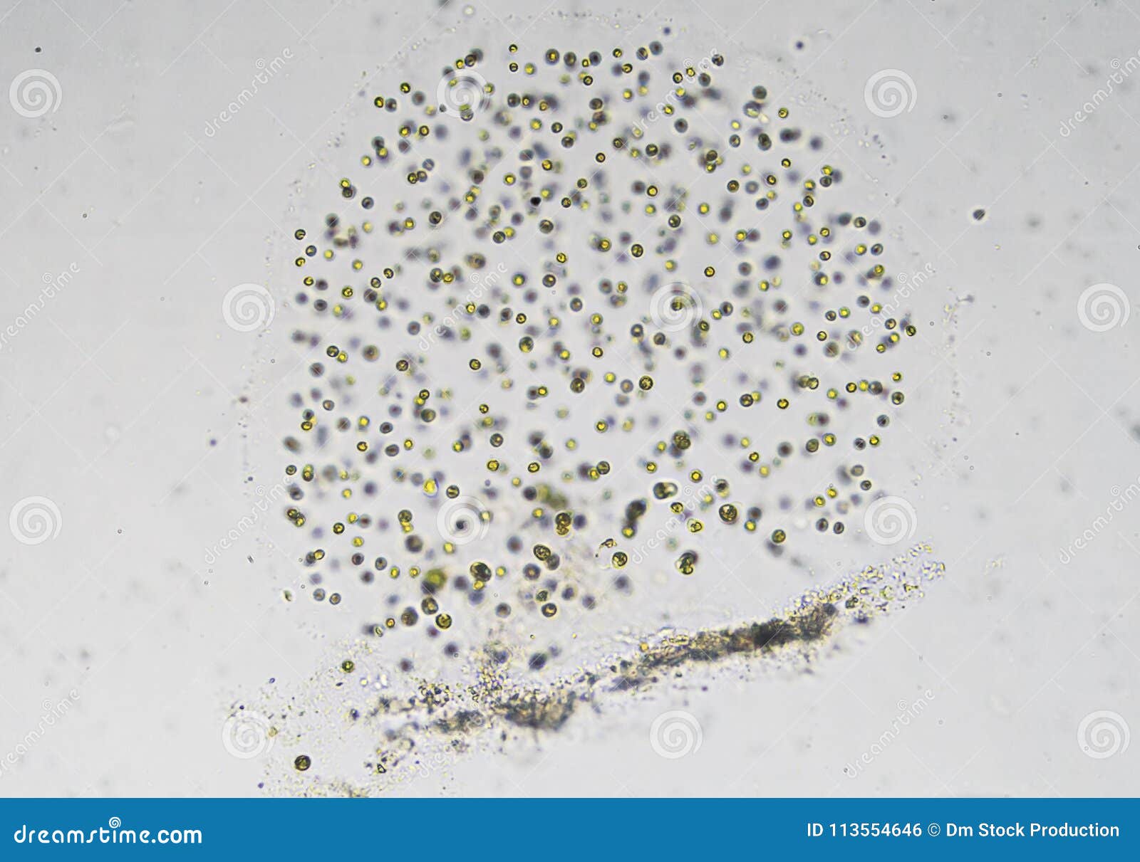 Spores Of Microscopic Fungi Stock Photo | CartoonDealer.com #153715344