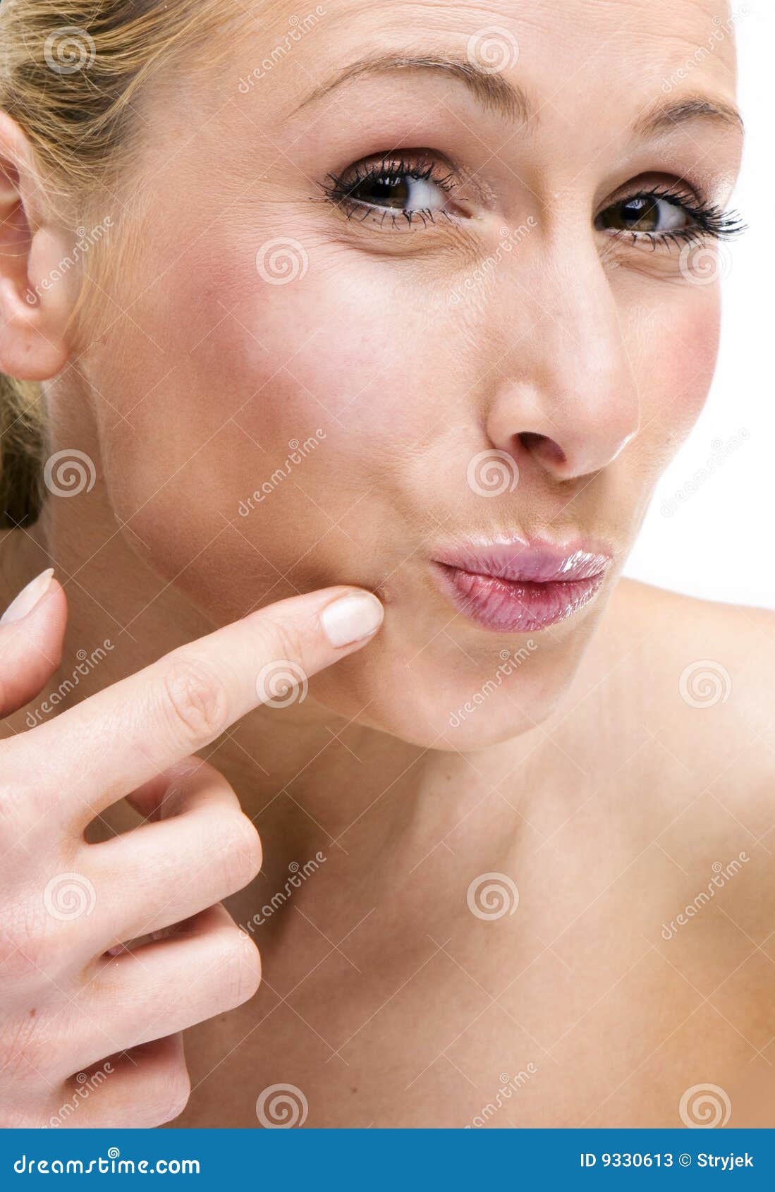 Big Red Pimple Abscess On The Skin, Close-up, Pimple Inflammation On ...