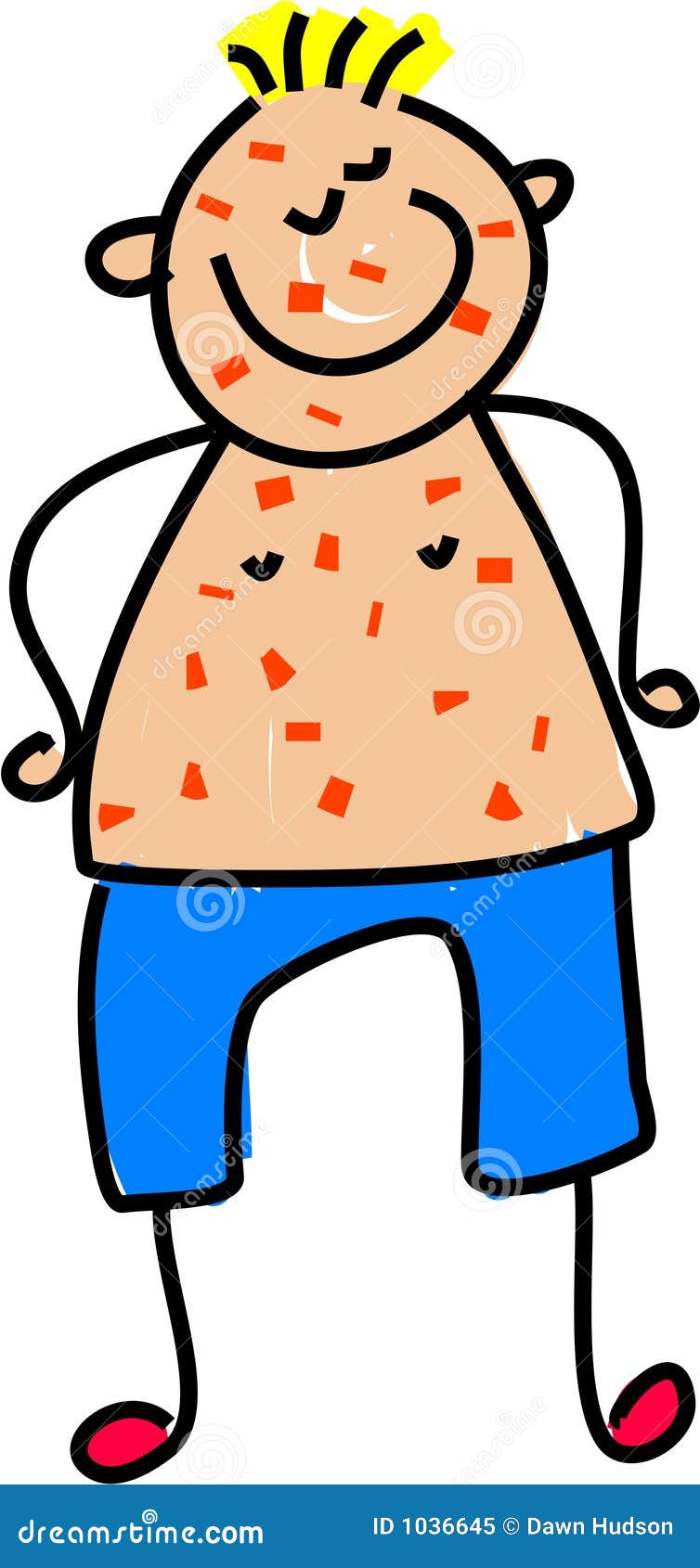 Spotty kid stock illustration. Image of chickenpox, measles - 1036645