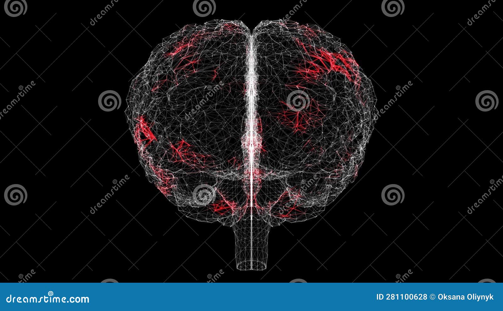 Spread of Virus through 3D Human Brain on Black Background. Visual ...