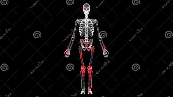 Spread of Virus through Volumetric Skeleton Monochrome on Black ...