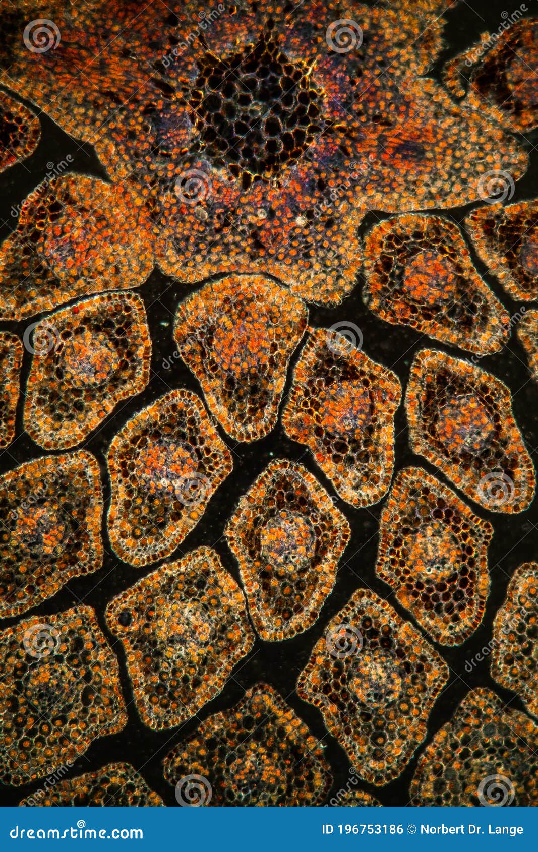 Spruce Needle in Cross Section Stock Photo - Image of enlarged, growth ...