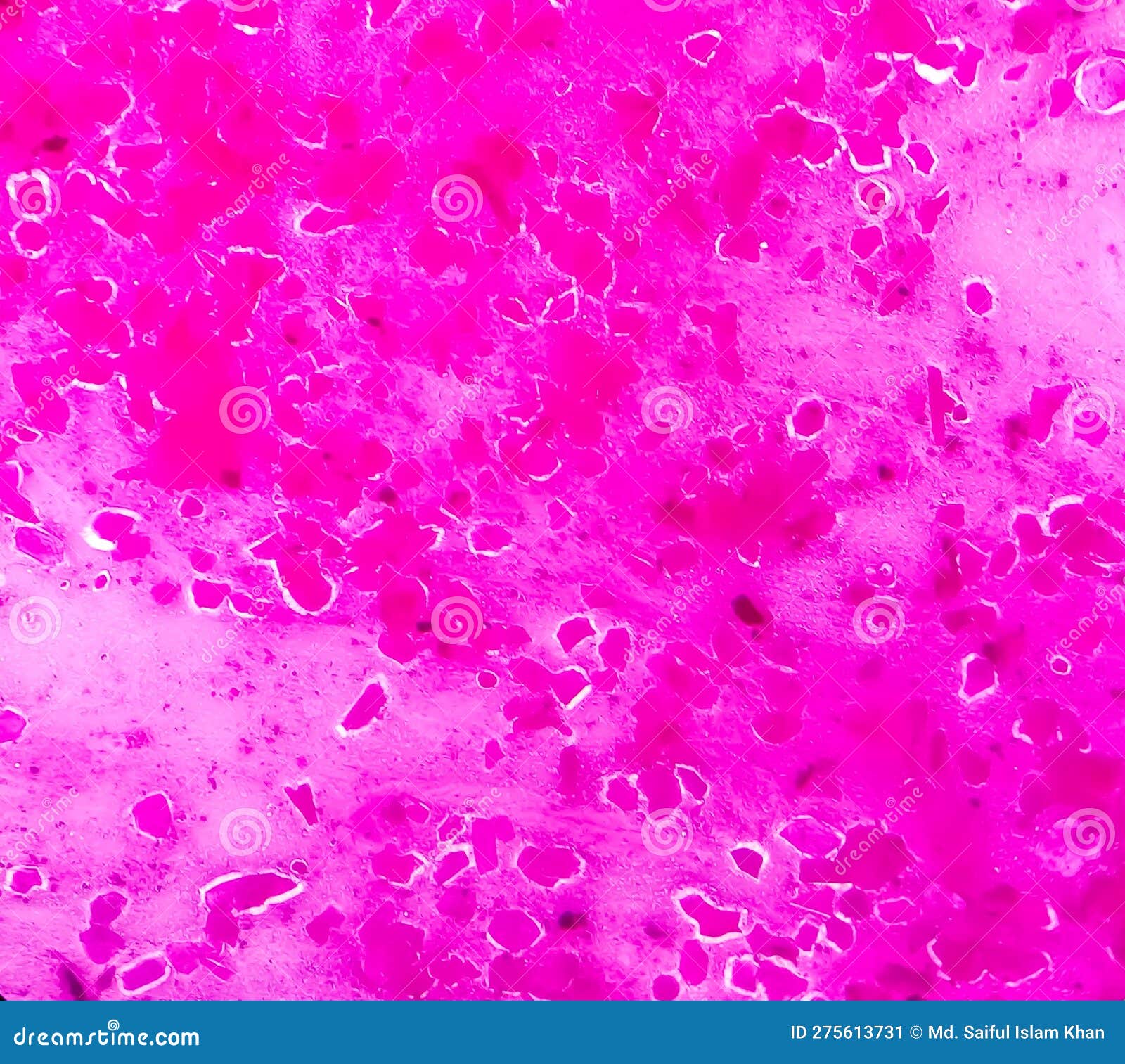 Sputum Smear Under Microscopy Showing Gram Positive Cocci Bacteria Stock Image Image Of 100x
