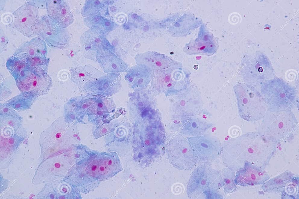 Squamous Epithelial Cell Cell Structure of Human Under Microscope View ...