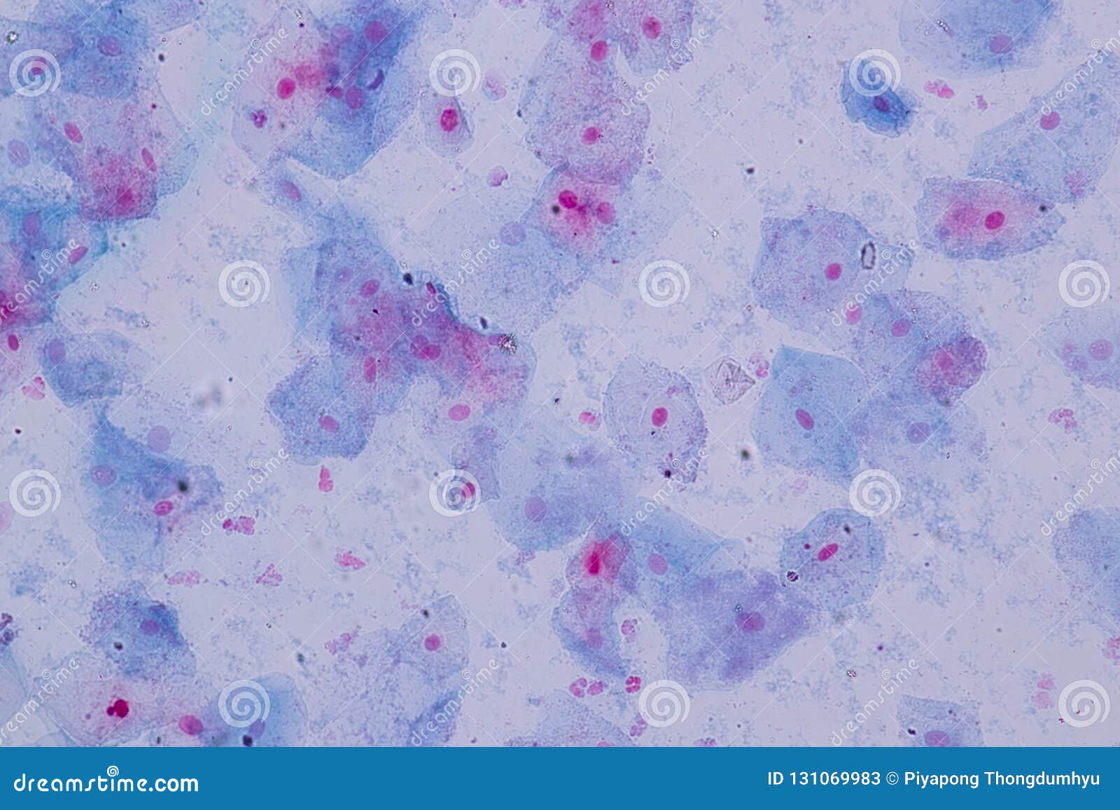 Human Epithelial Cells Under Microscope
