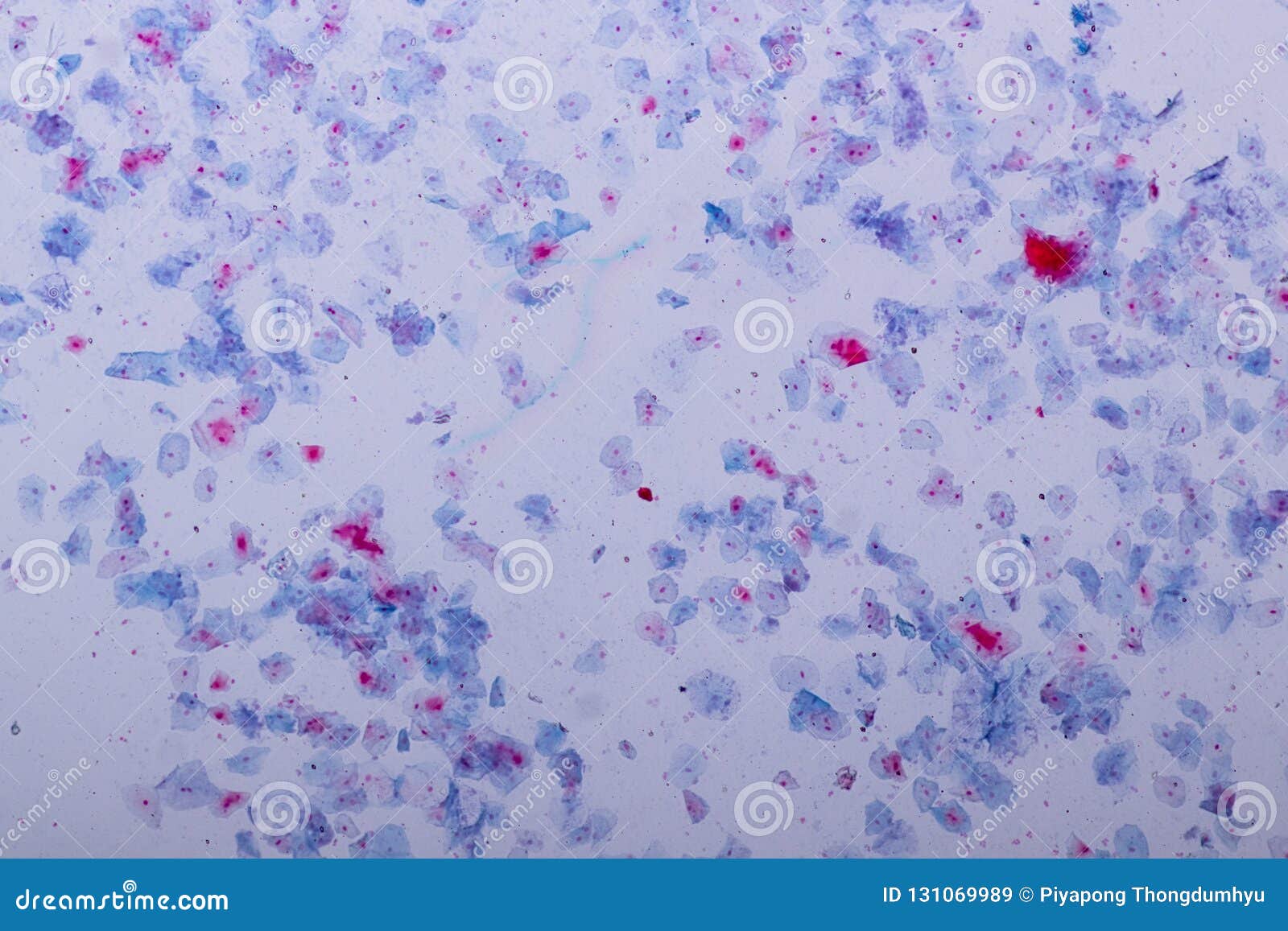 Squamous Epithelial Cell Cell Structure of Human Under Microscope View ...