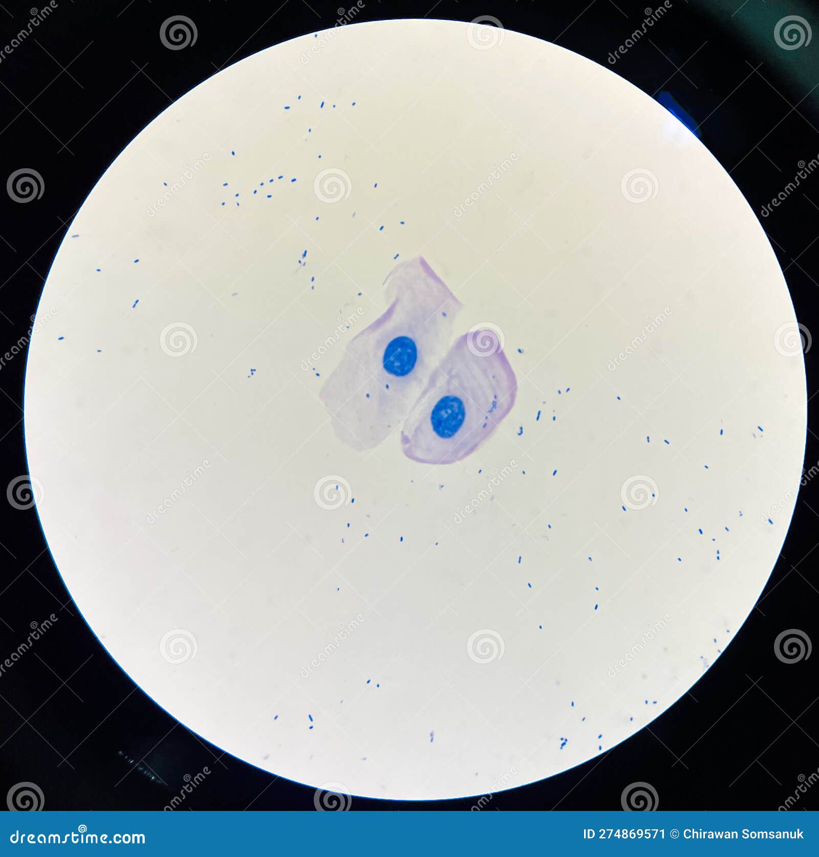 Squamous Epithelial Cell in Sputum AFB Stock Image - Image of ...