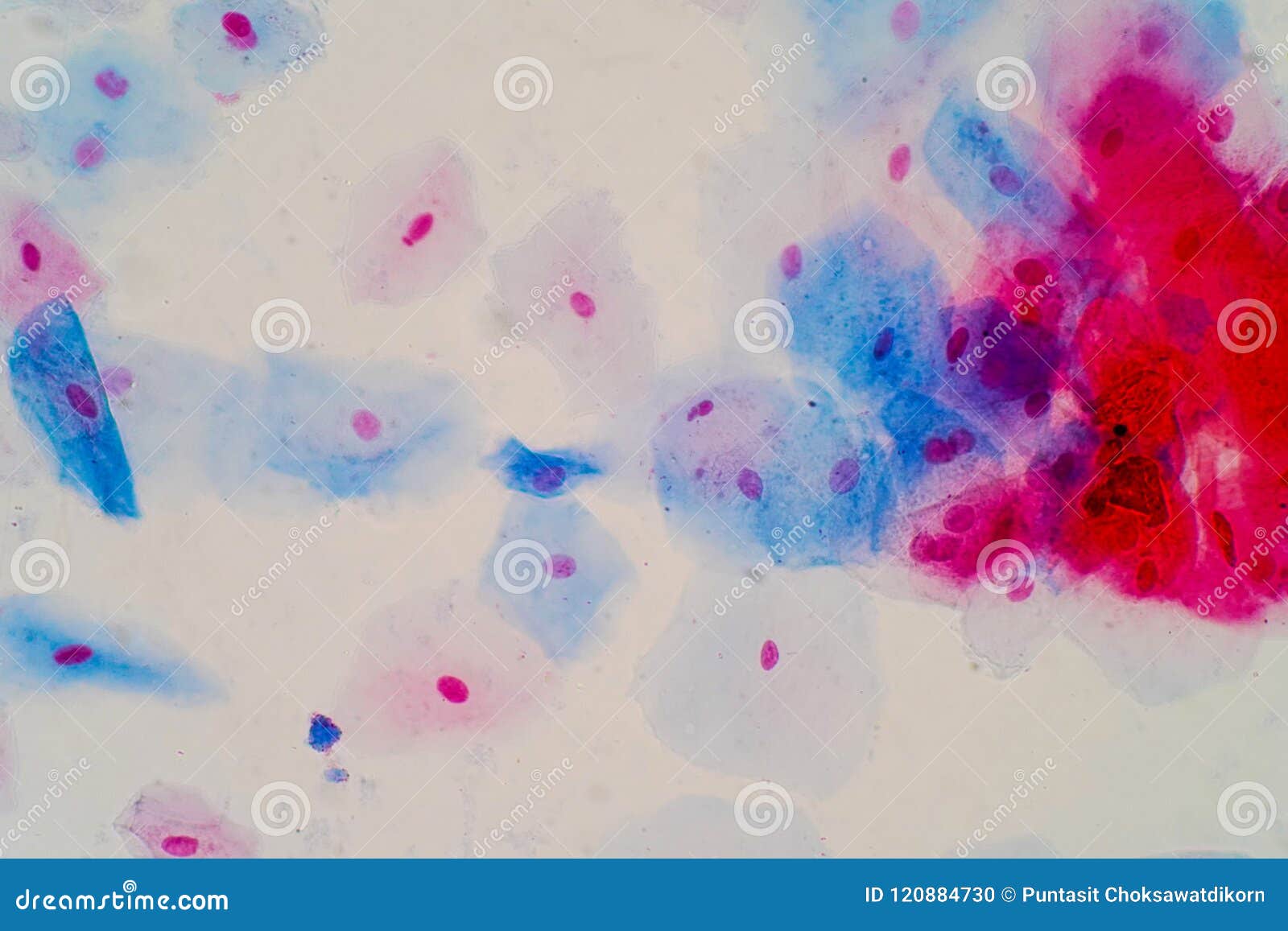 Squamous Epithelial Cells Under Microscope View for Education Hi Stock ...