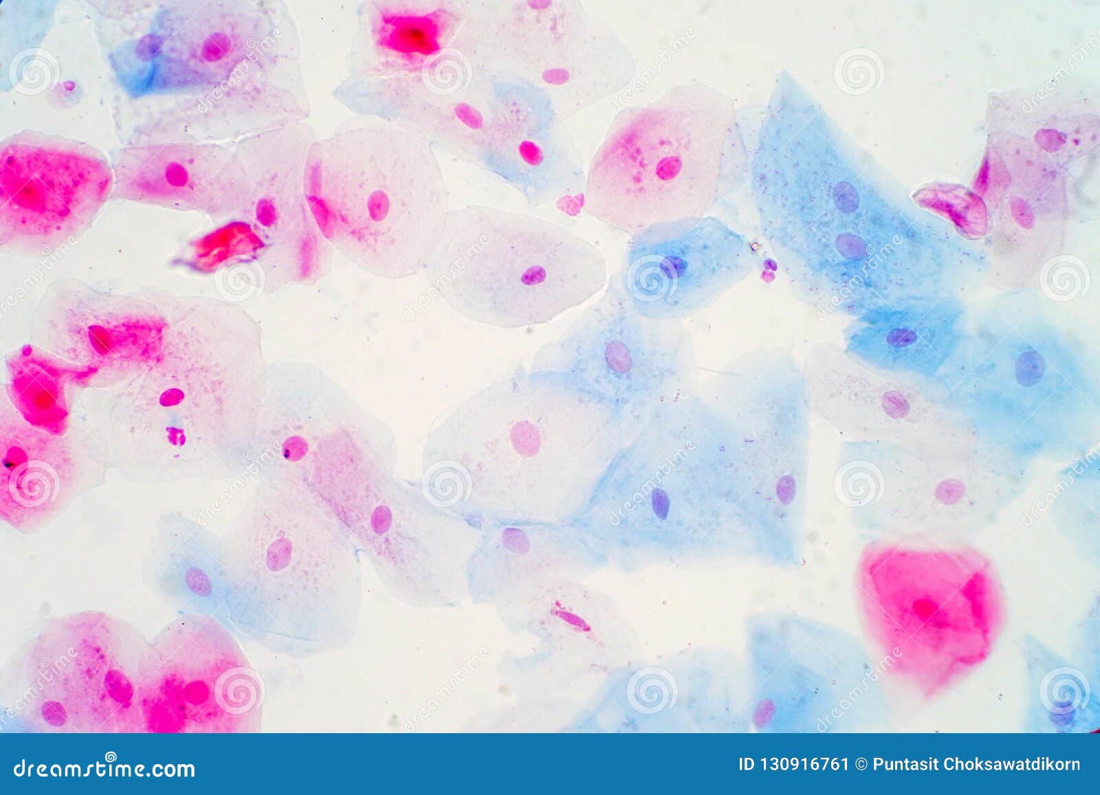 Squamous Epithelial Cells