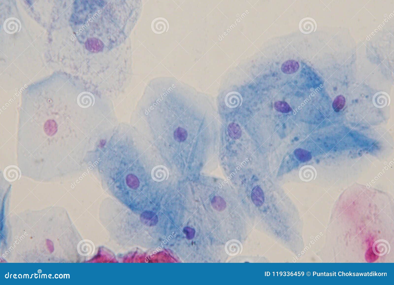 Squamous Epithelial Cells Under Microscope View for Education Hi Stock ...