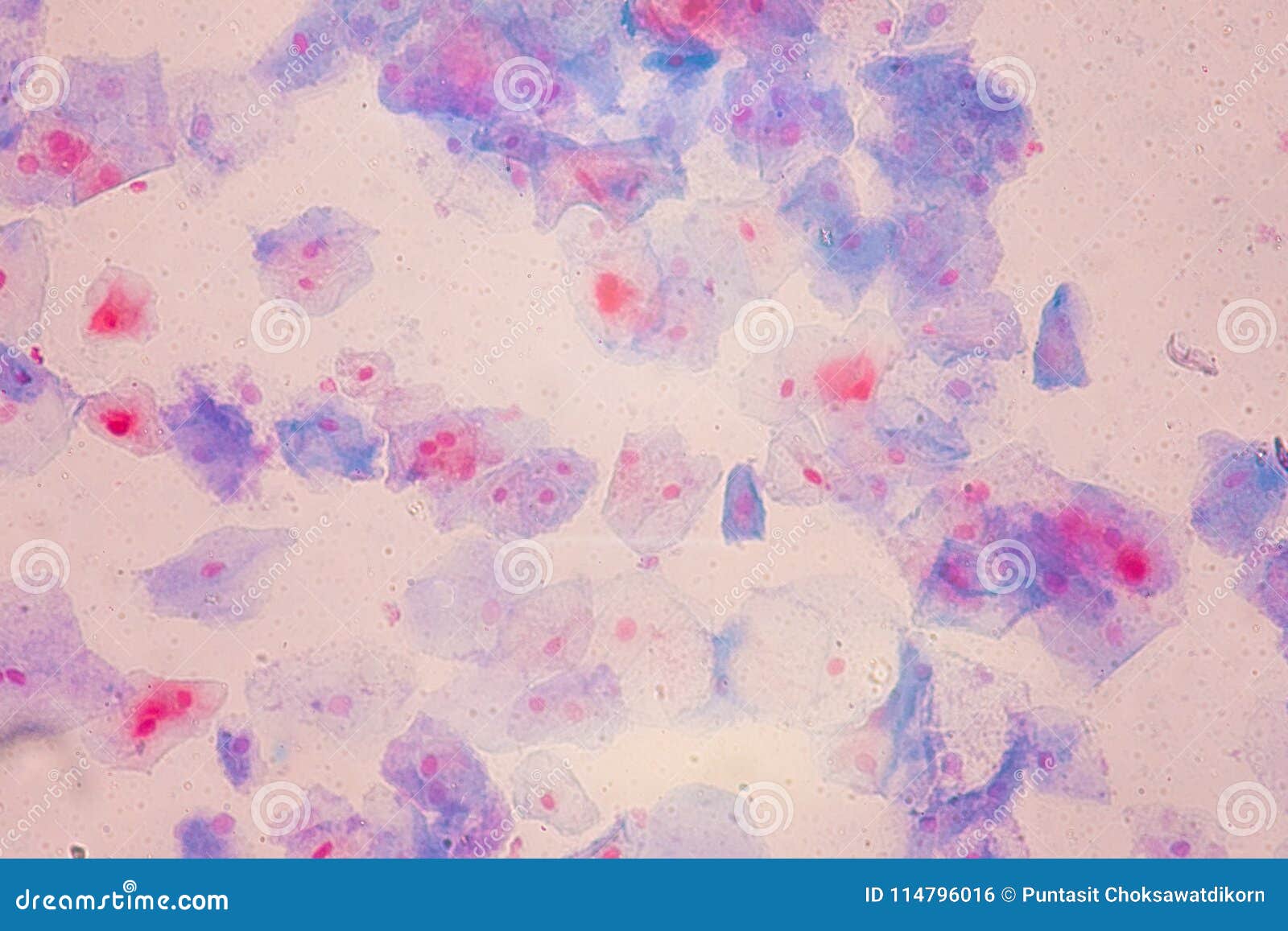 Squamous Epithelial Cells Under Microscope View for Education Hi Stock ...