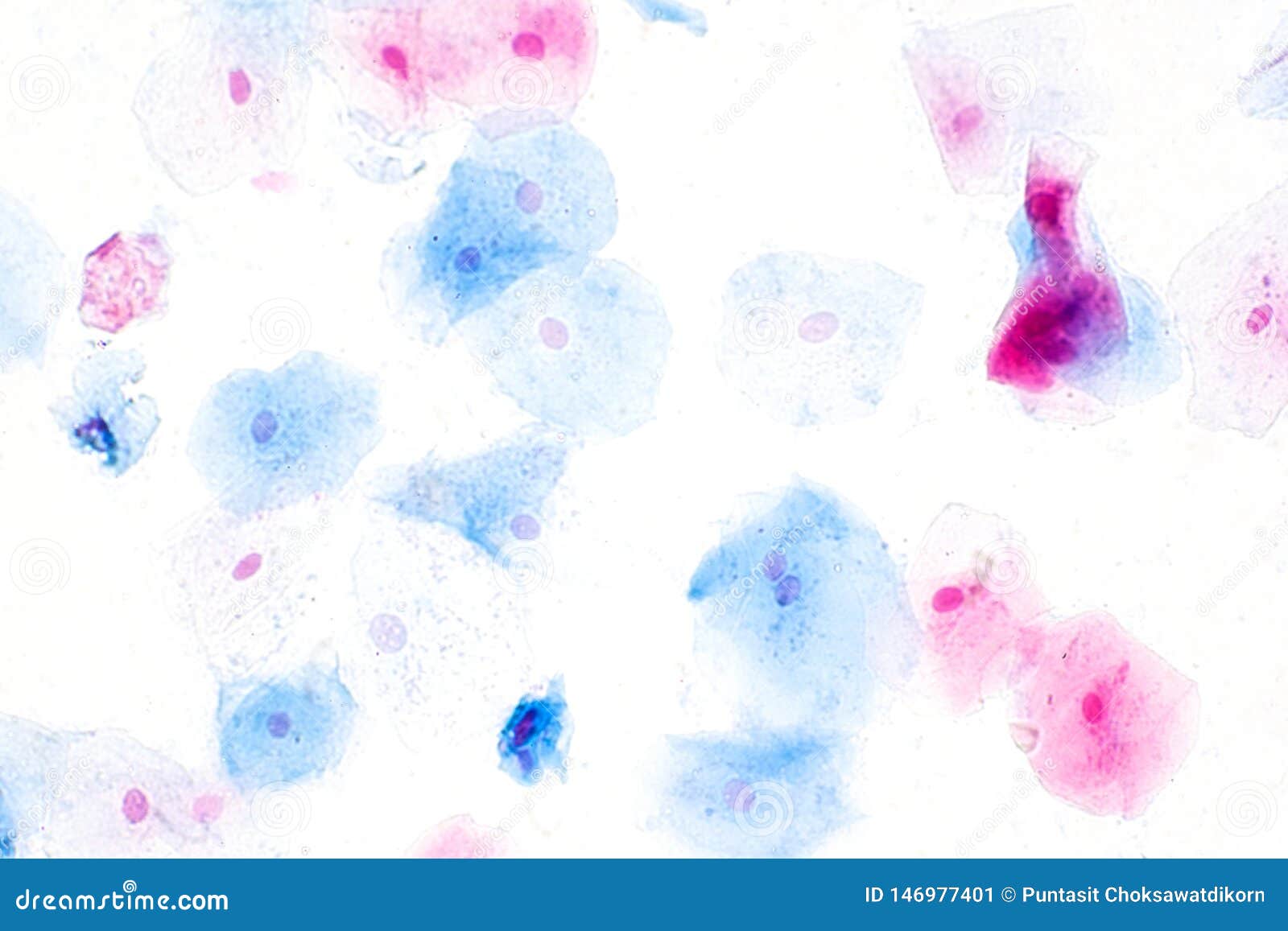Histology Of Human Compact Bone Tissue Under Microscope View For ...