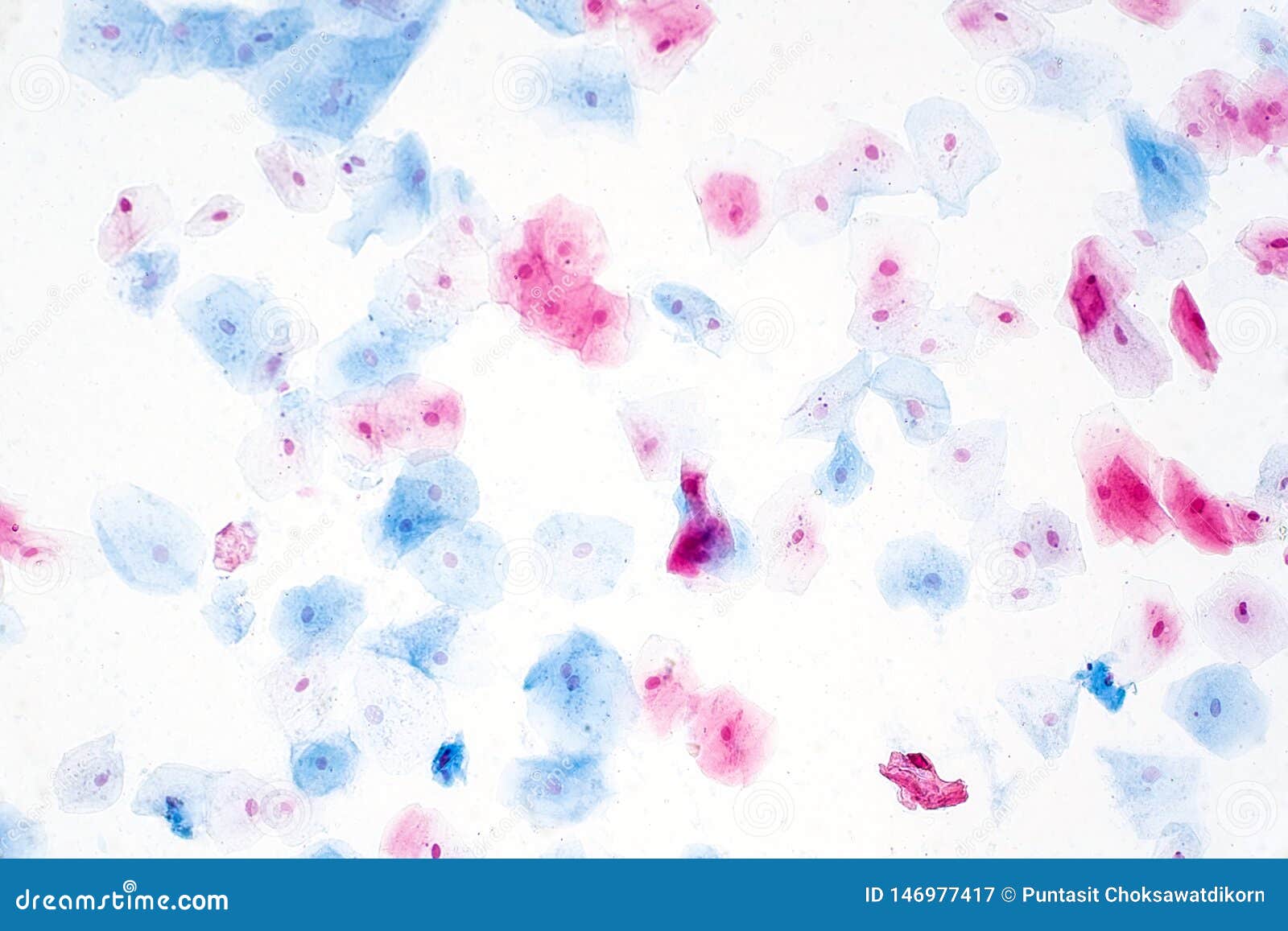 Histology Of Human Compact Bone Tissue Under Microscope View For ...