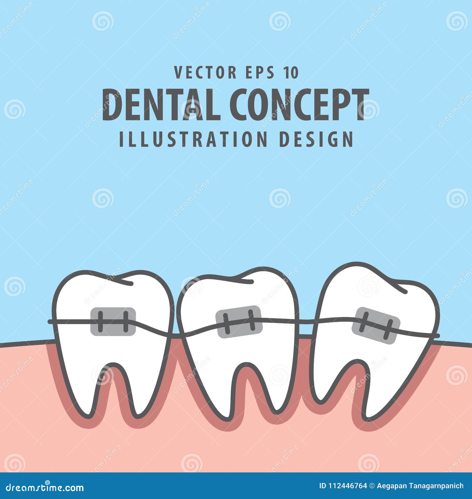 Square Banner Braces Teeth Illustration Vector On Blue Backgrou Stock