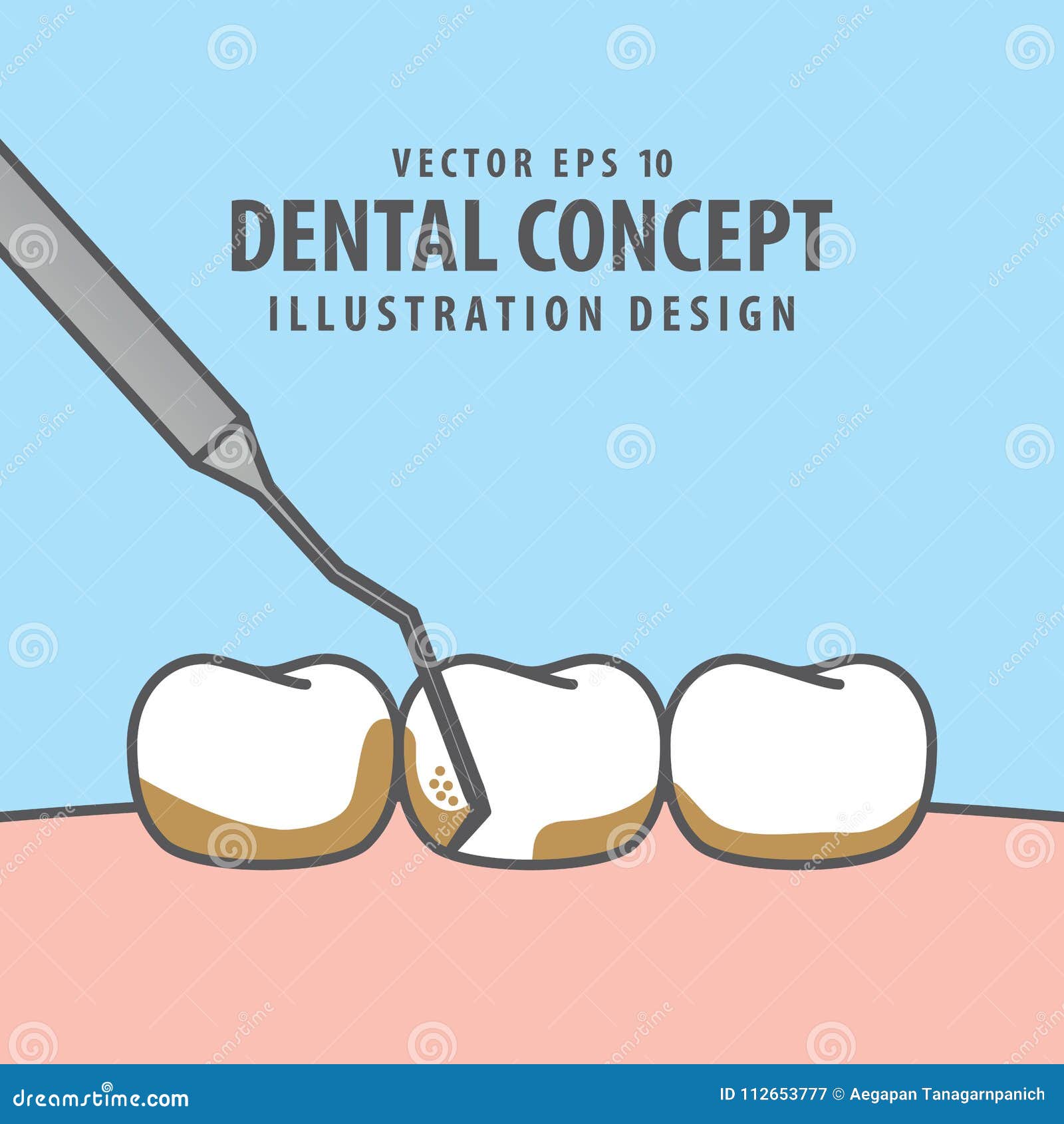 Scaling Teeth Illustration Vector On Blue Background. Dental Con ...