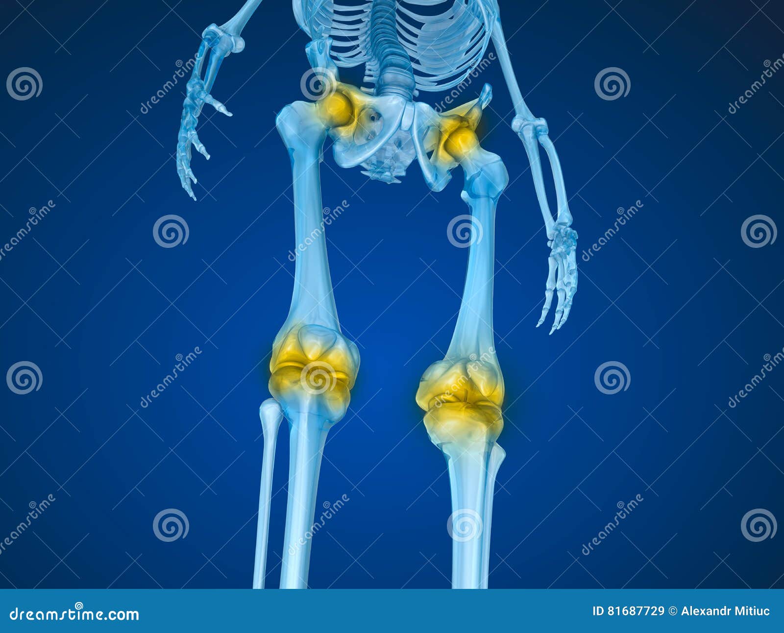 Squelette Humain Et Joints Damajed Illustration Stock - Illustration du ...