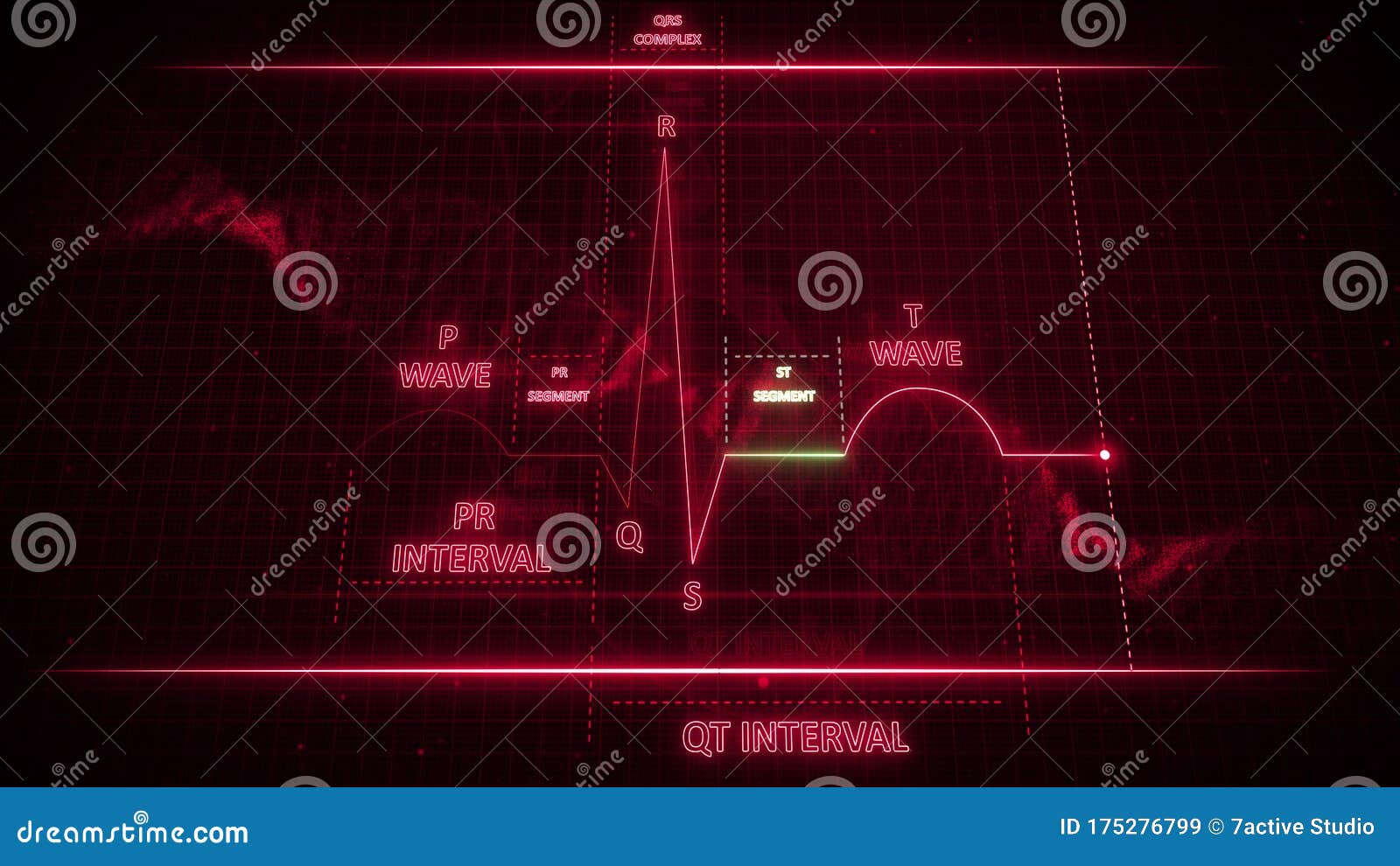 ST Segment from Electrocardiogram Wave or ECG or EKG Stock Illustration ...